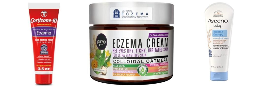 Top 5 Eczema Creams for Kids: A Parent's Buying Guide